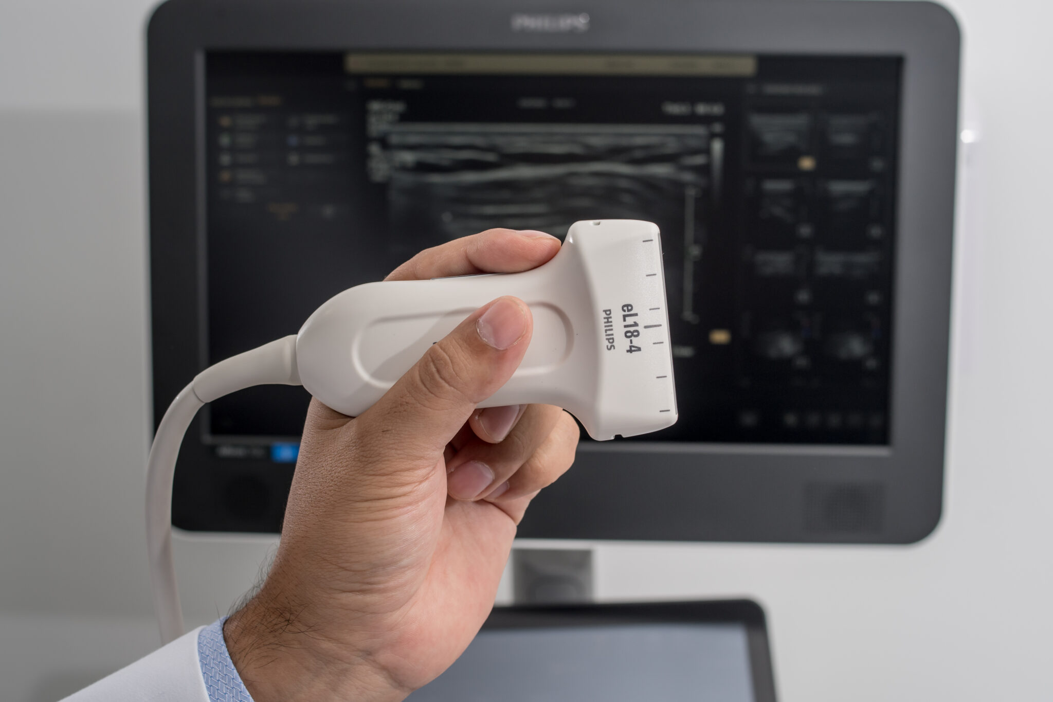 ECOGRAFÍA DE PARTES BLANDAS – ECOAVAN